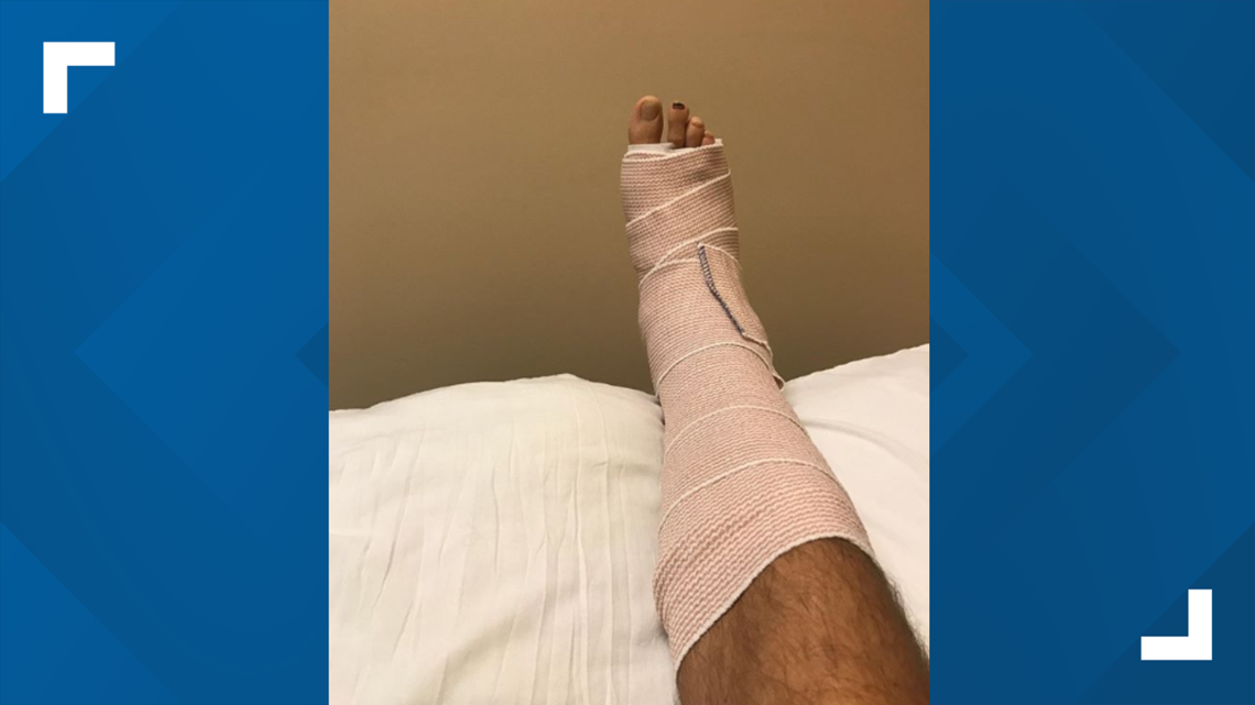 Ouch! Pro runner steps into Michigan pothole, breaks leg | wzzm13.com