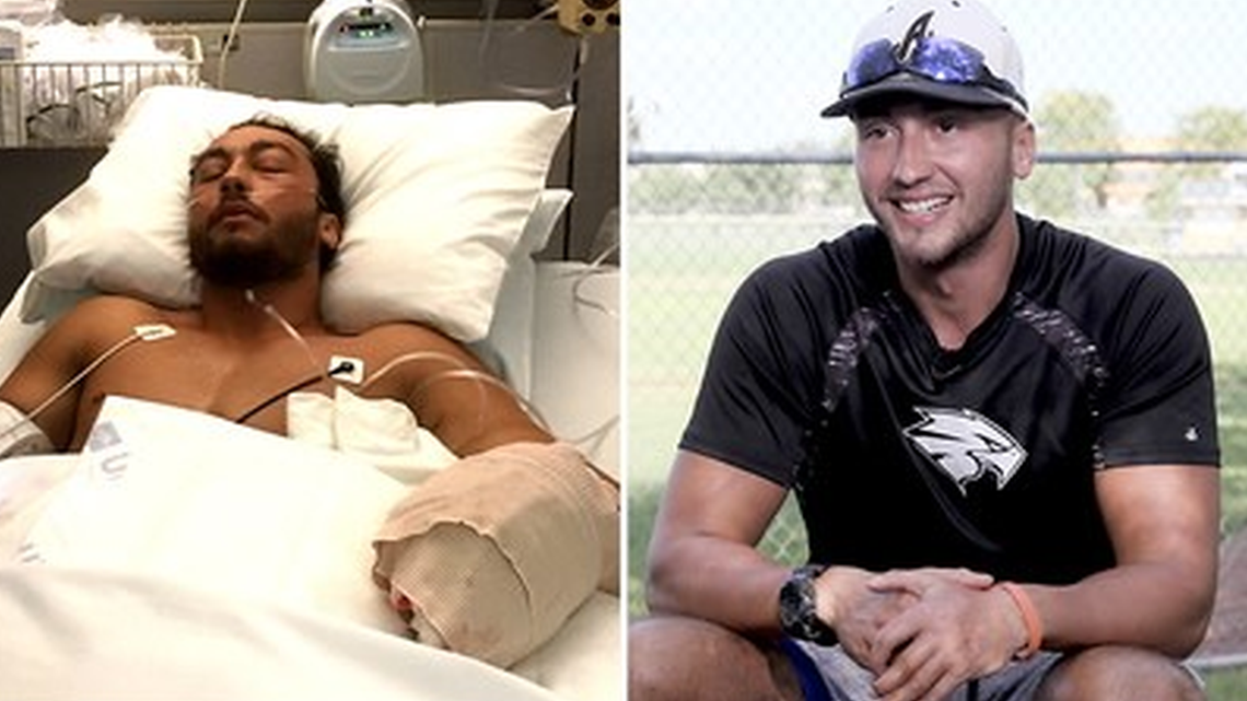 Baseball player throws again after losing hand in lawnmower accident ...