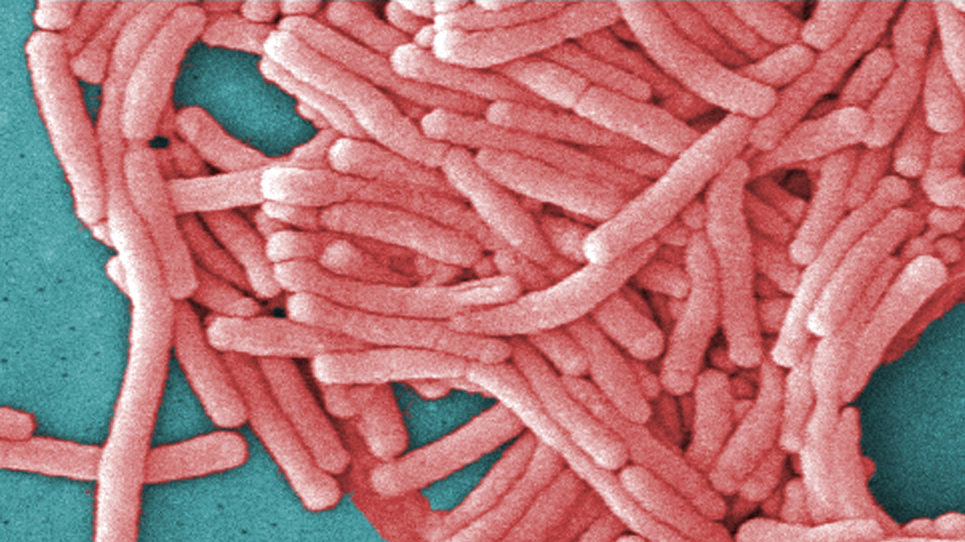Mich. Legionnaires' disease, Pontiac fever cases up amid warmer temps ...