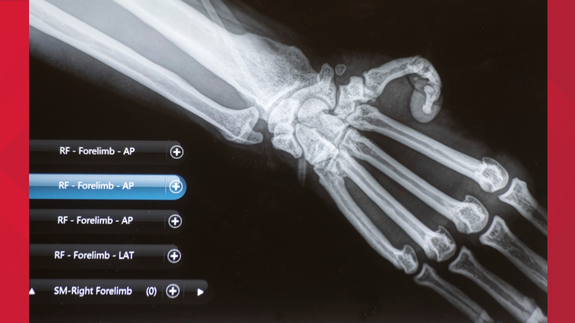 Monkey business: Grand Rapids hand surgeon examines chimpanzee | wzzm13.com