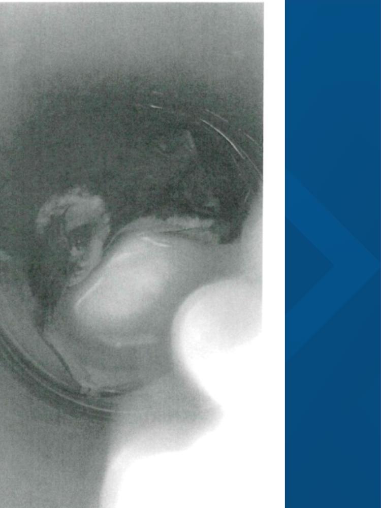 Grand Rapids woman sues Monster after allegedly finding mouse in drink ...