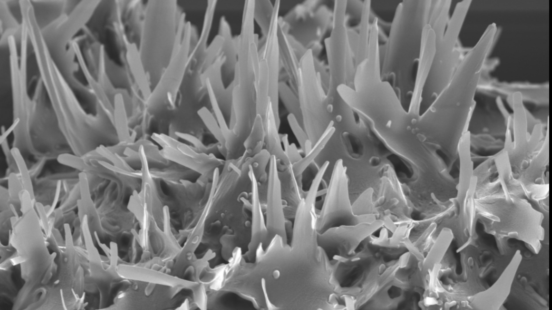 Bacteria may be cause for heart related infections | wzzm13.com