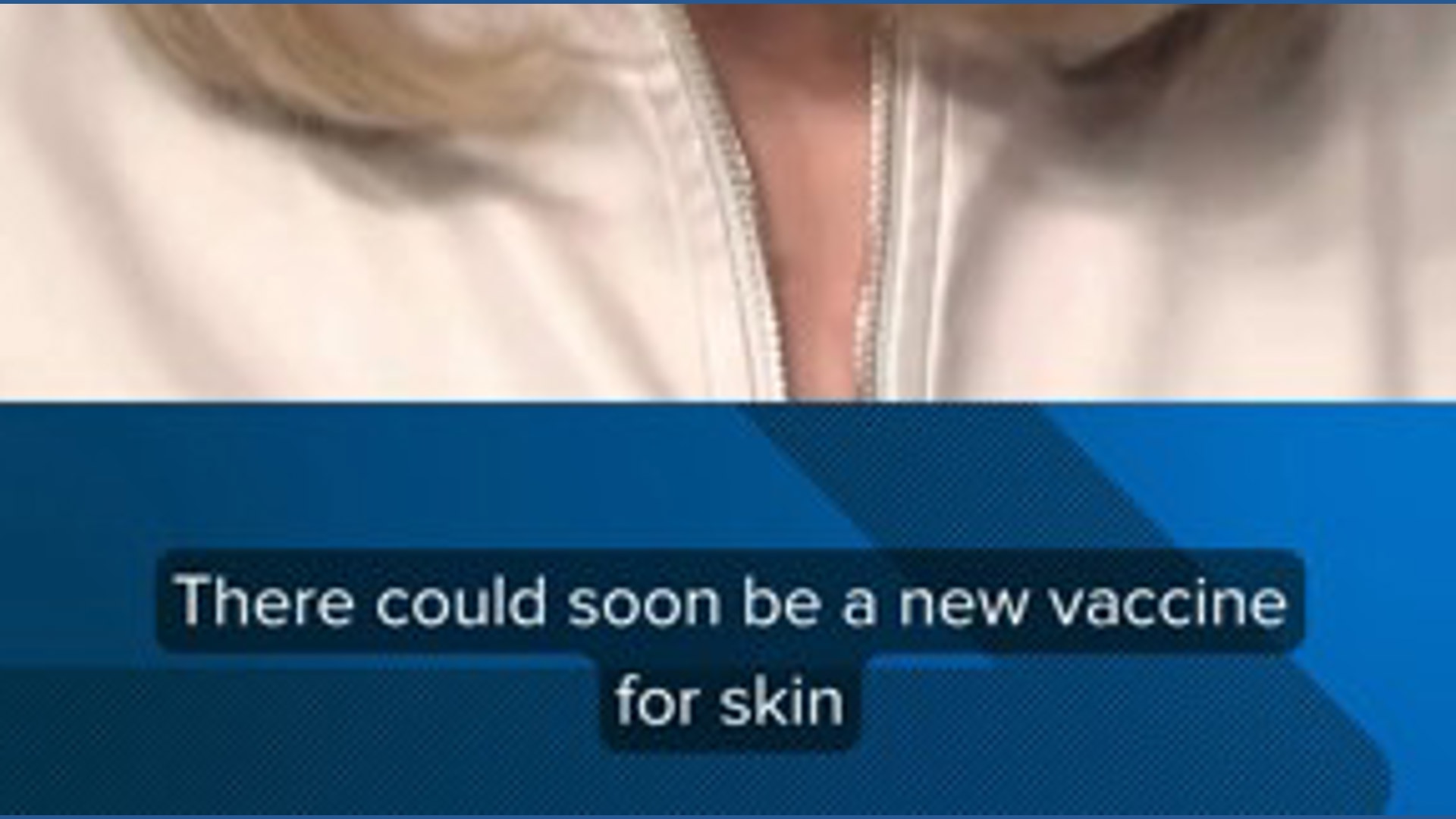 New melanoma vaccine shows promise in preventing skin cancer return ...
