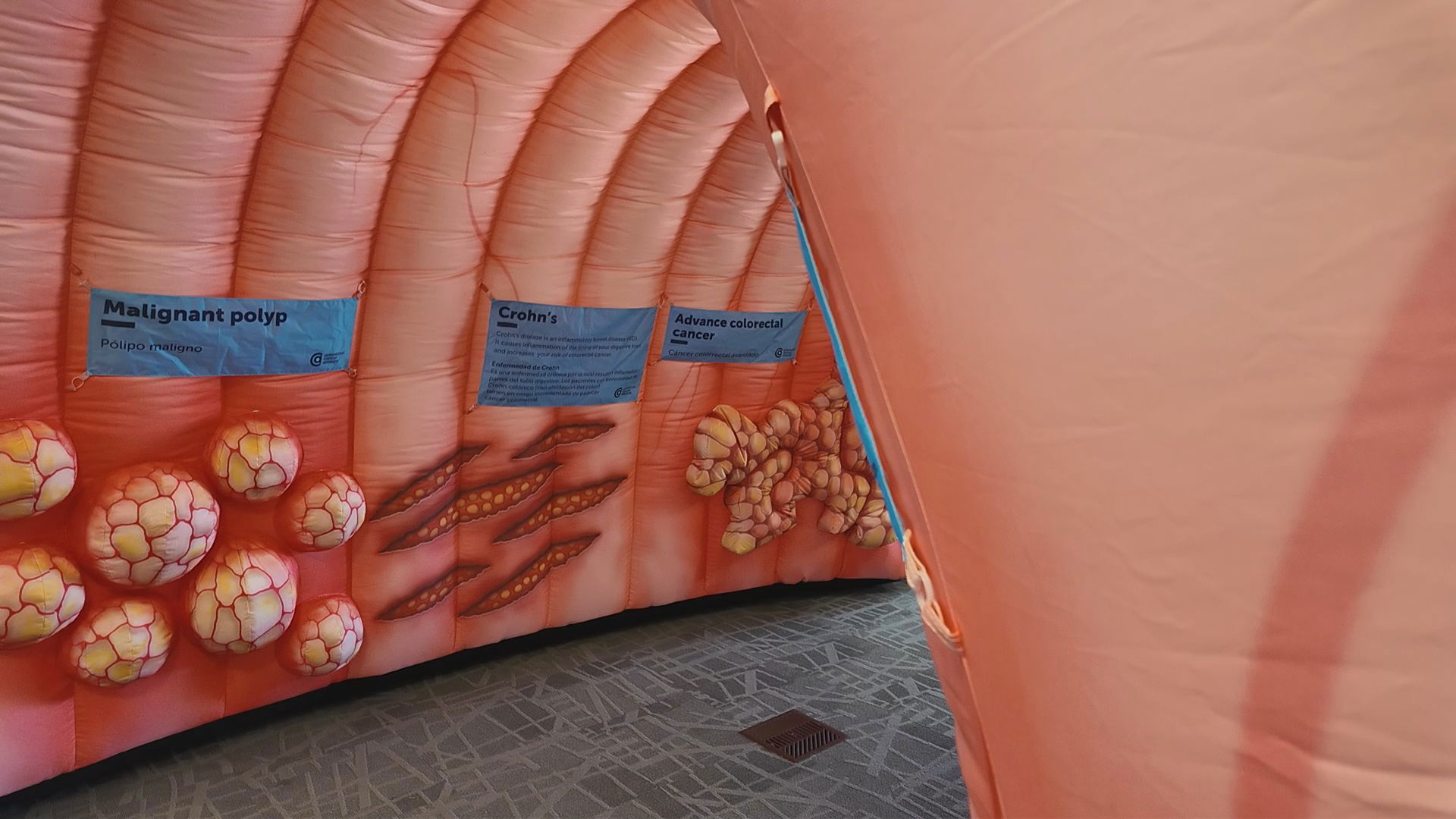 'Colin the Inflatable Colon' teaches about colon cancer | wzzm13.com