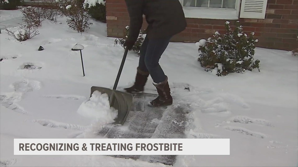 Tips for recognizing and treating frostbite | wzzm13.com