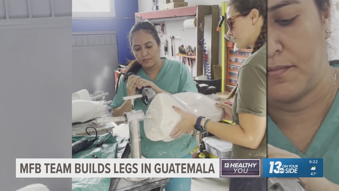 'Right to mobility': Mary Free Bed team brings prosthetics to Guatemala ...