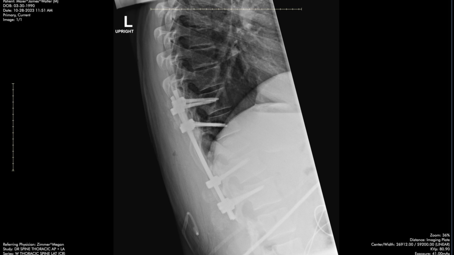 Grand Rapids man leaves hospital following 15-foot fall | wzzm13.com