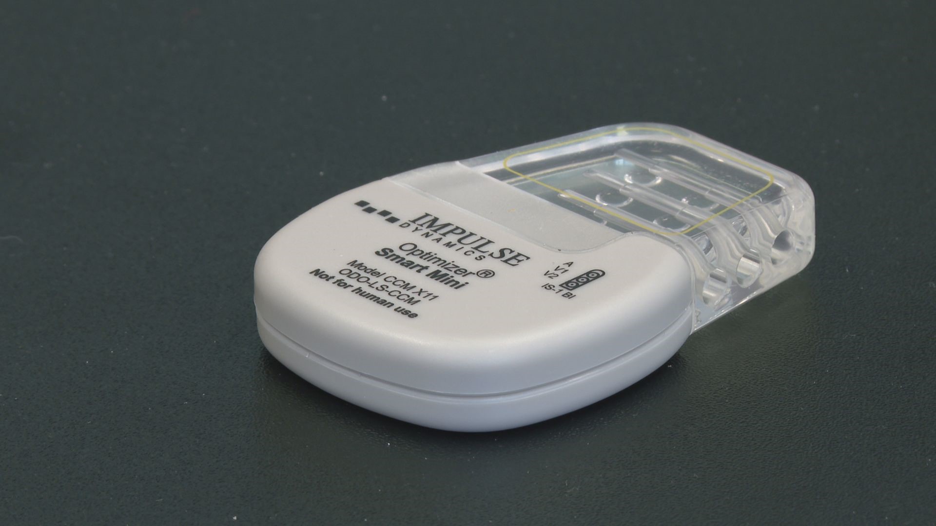 Man receives first CCM therapy for heart failure in West MI | wzzm13.com