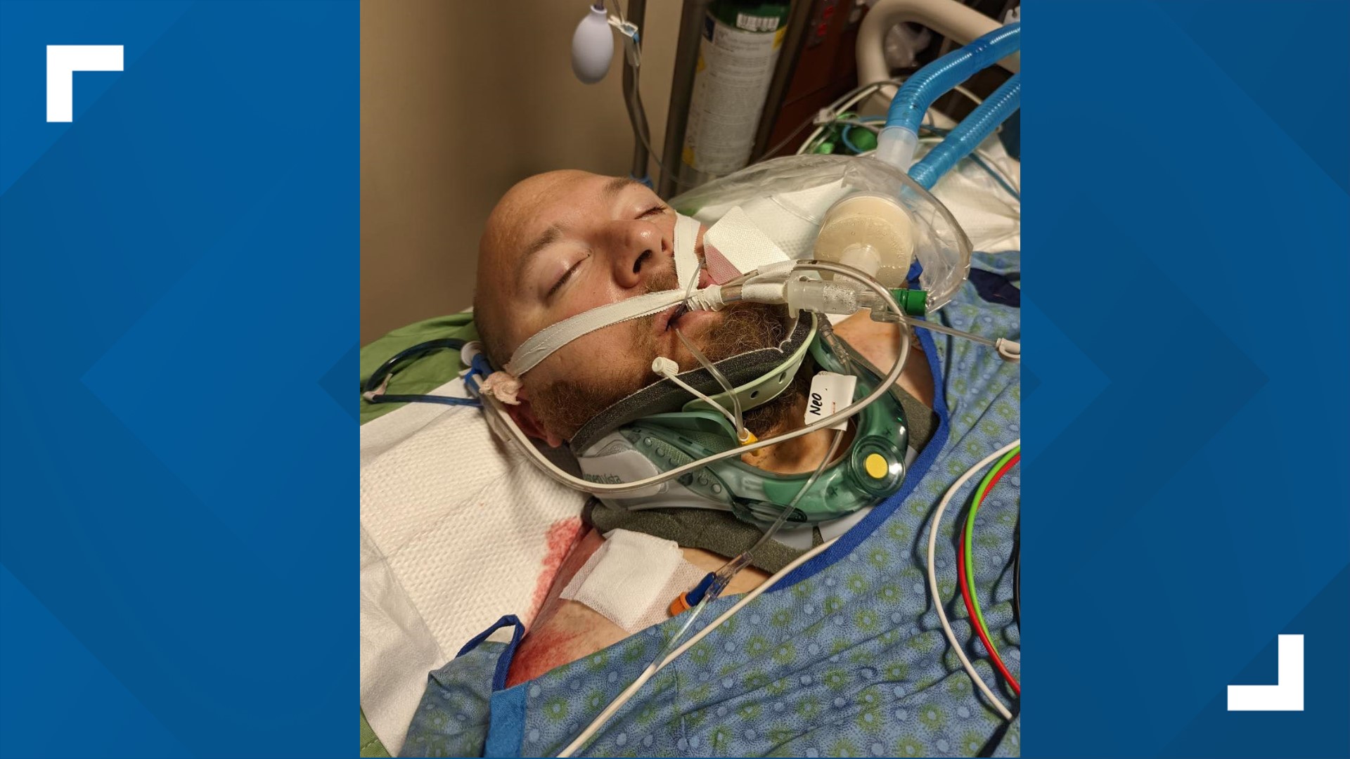 West Michigan man recovers after motorcycle crash | wzzm13.com